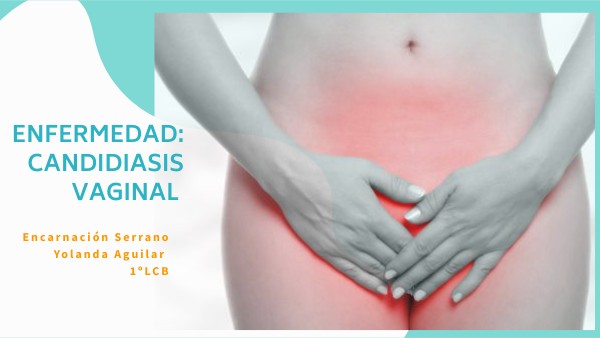 Candidiasis | Genially