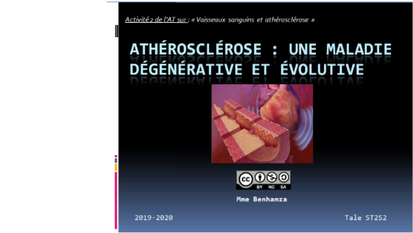 ST2S - BPH - Athérosclérose | Genially