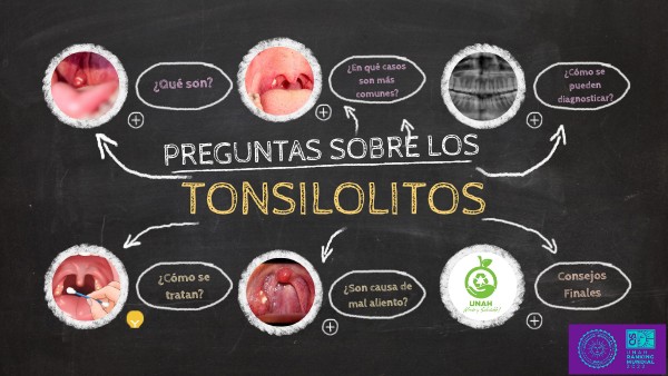 Tonsilolitos | Genially