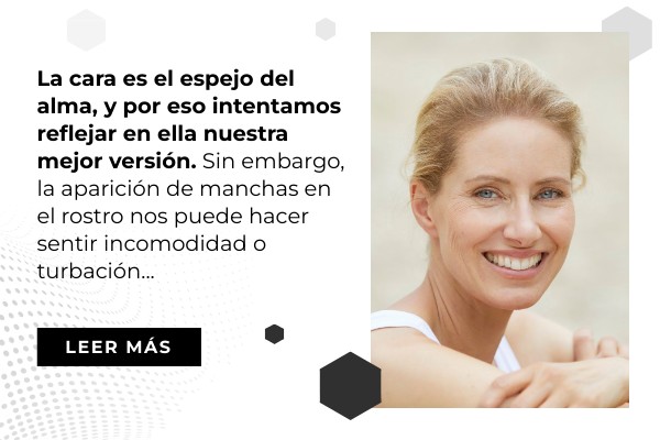 23645_INT_BELLA AURORA | Genially