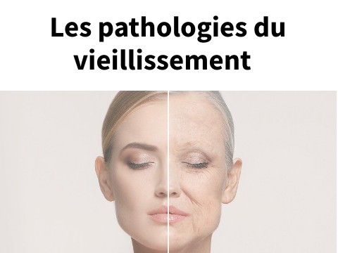 les pathologies du vieillissement | Genially