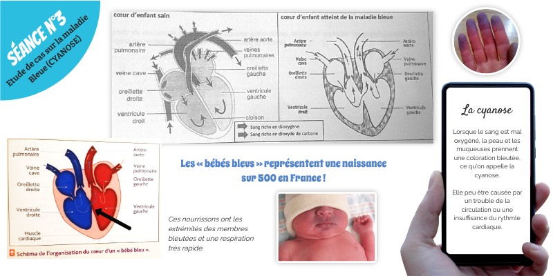 séance n°3 cyanose