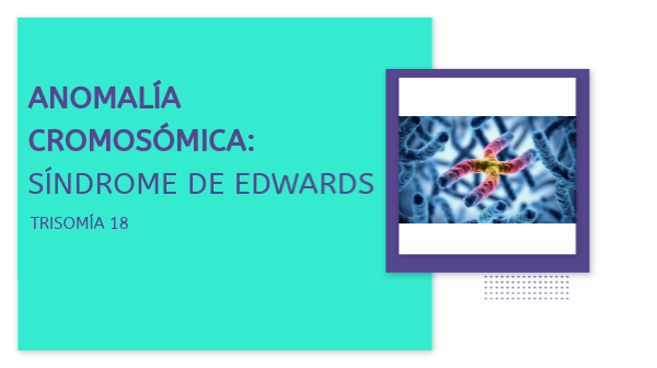 SINDROME DE EDWARDS | Genially