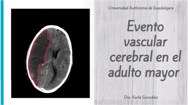 EVC VIDEO | Genially