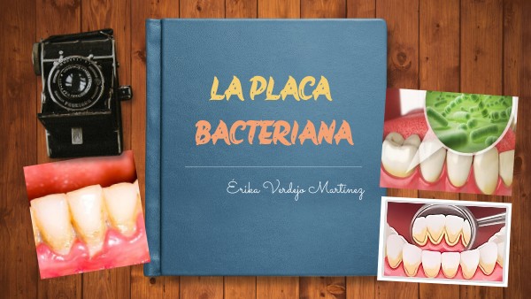 Placa bacteriana (ODONTOLOGÍA)