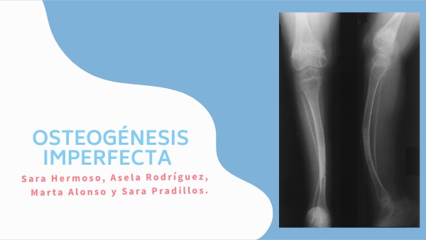 Osteogénesis Imperfecta