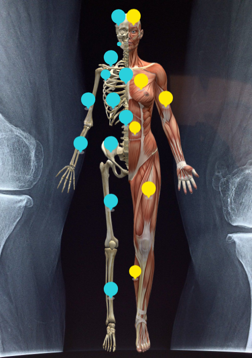L'ESQUELET I ELS MÚSCULS | Genially