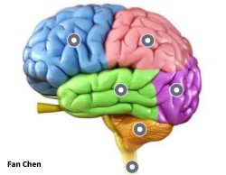 Interactive image of the Brain