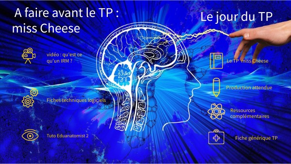 TP miss Cheese | Genially