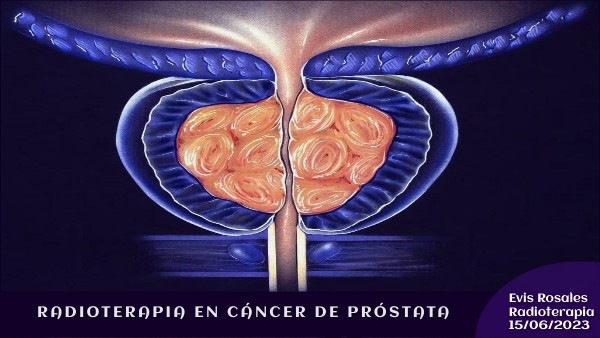 Próstata | Genially