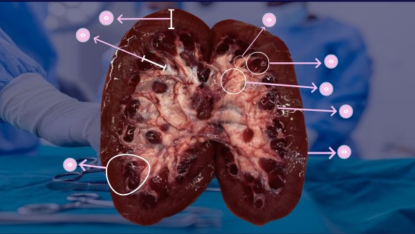 Ronyó Pràctica 2 Escenari 3