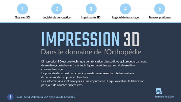IMPRESSION 3D Anne veaute