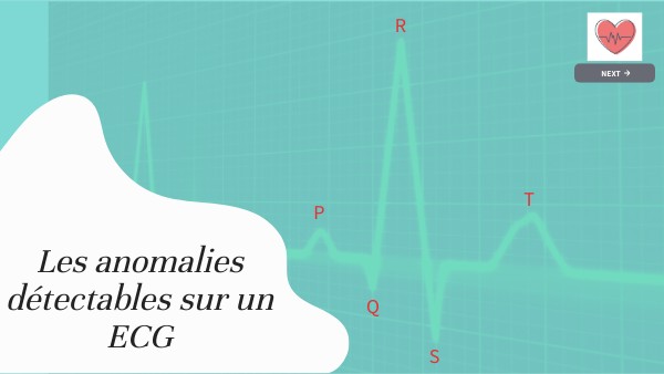 Les anomalies des ECG | Genially