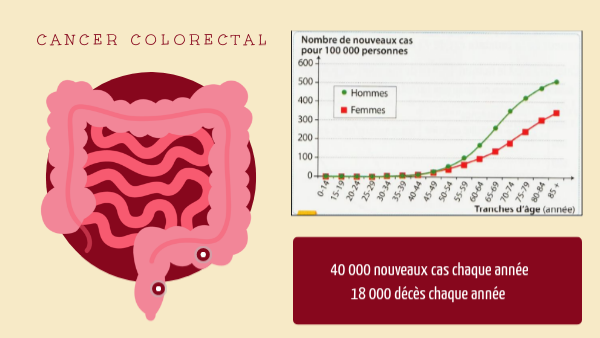 Cancer colorectal | Genially