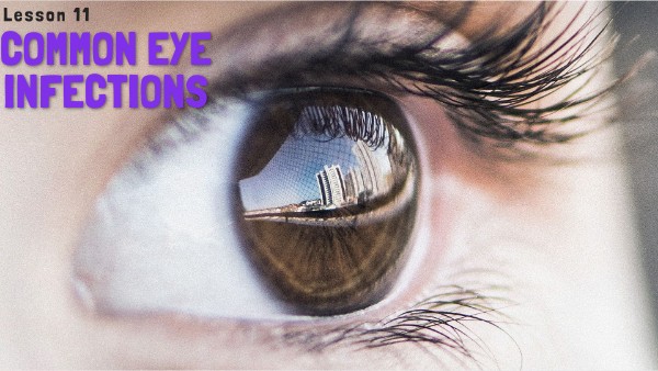 G6 Lesson 11 Common Eye Infections