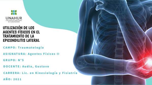 TRABAJO DE EXTENSIÓN - AF2 | Genially