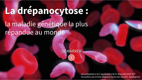 La drépanocytose | Genially