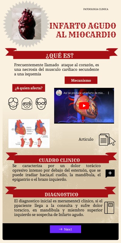 Infarto agudo al miocardio | Genially