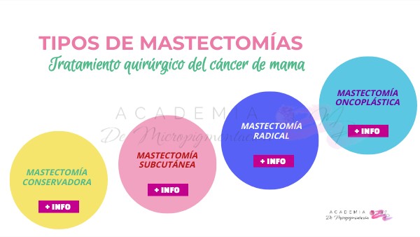 ebook-TIPOS DE MASTECTOMIA | Genially
