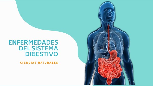 ENFERMEDADES DEL SISTEMA DIGESTIVO | Genially