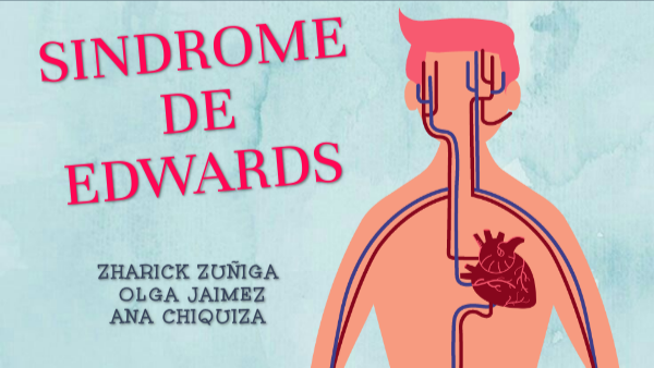 Sindrome de edwards | Genially