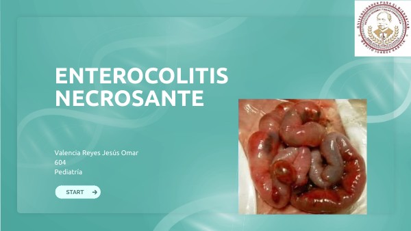 Enterocolitis Necrotizante | Genially