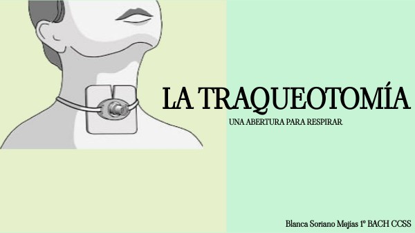 LA TRAQUEOTOMÍA | Genially