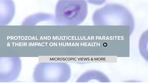 Protozoal and Multicellular Parasites