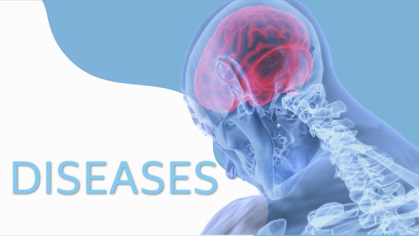 Diseases