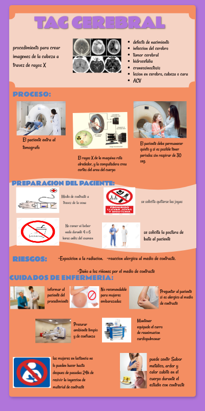 tac cerebral | Genially