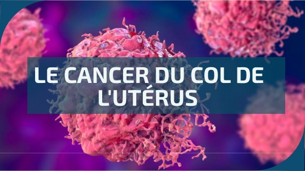 Le cancer | Genially