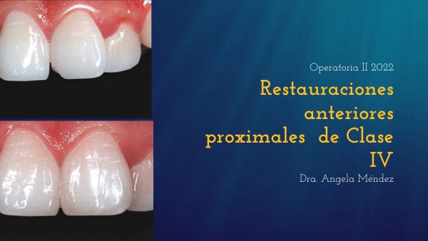 Restauraciones de Clase | Genially