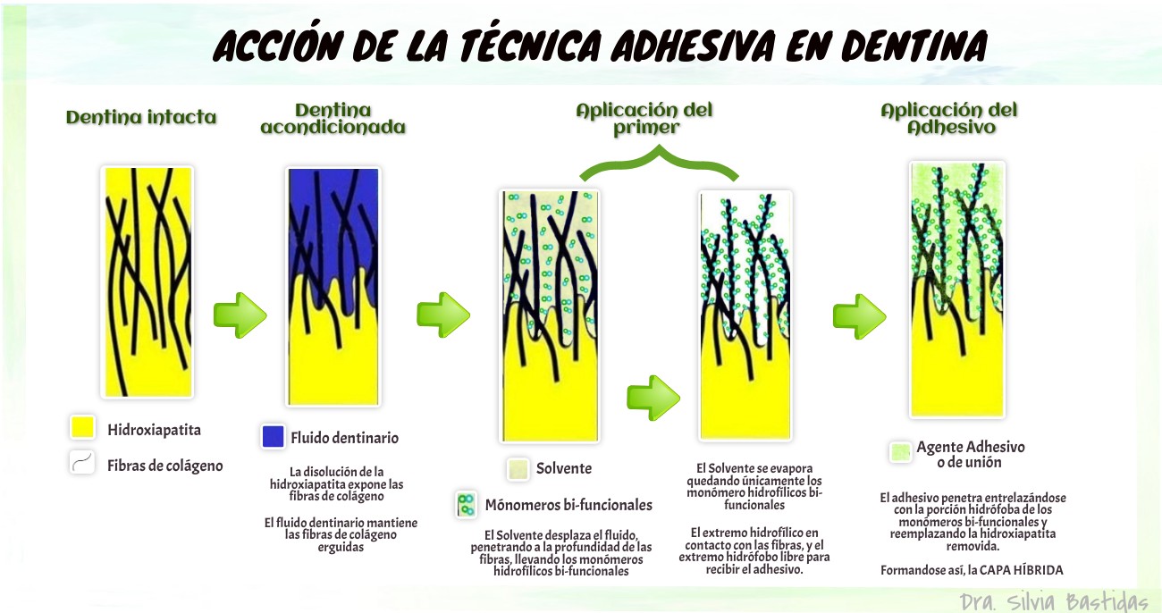 Acción del adhesivo en dentina | Genially