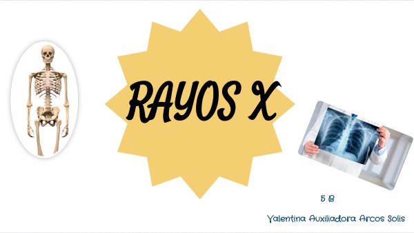 Rayos X | Genially