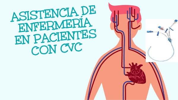 Cuidados CVC | Genially