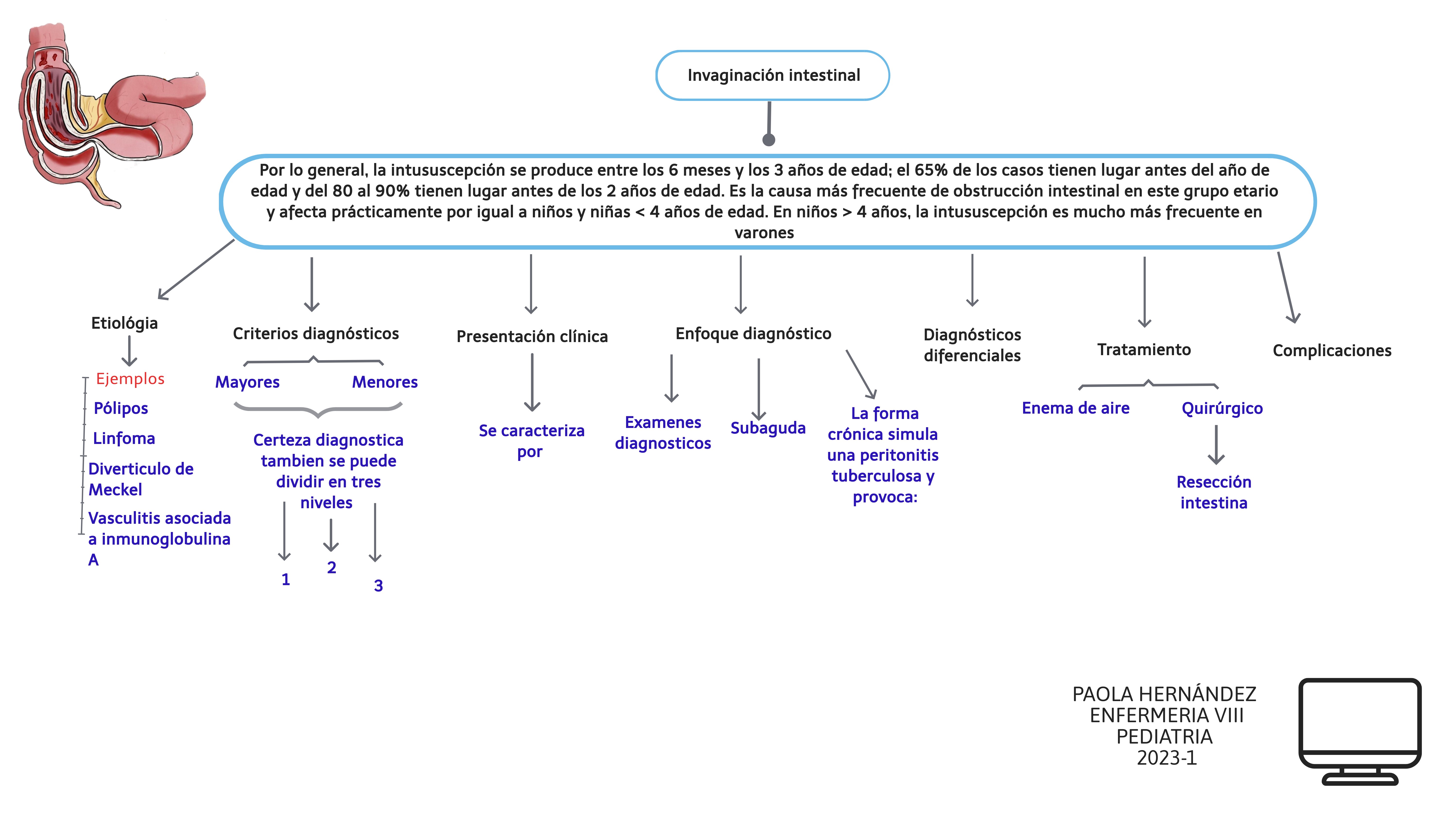 Invaginación intestinal | Genially