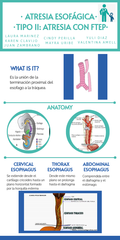 Atresia Esofágica | Genially