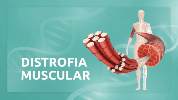 Distrofia Muscular | Genially