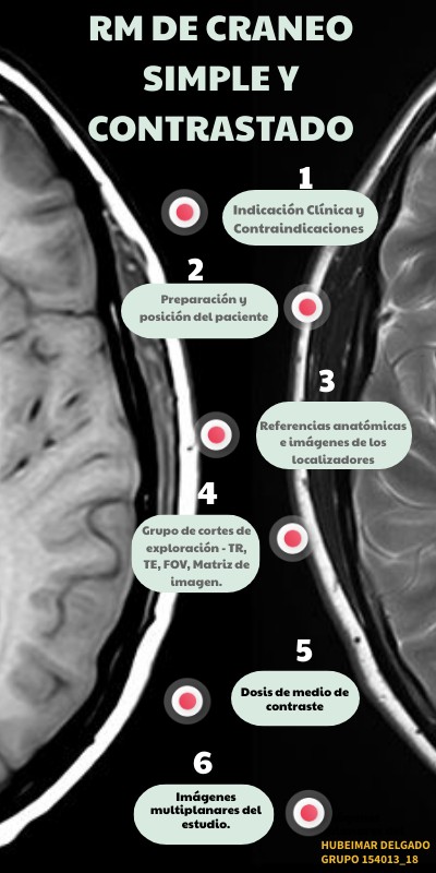 PROTOCOLOS RM DE CRÁNEO SIMPLE Y CONTRASTADO | Genially