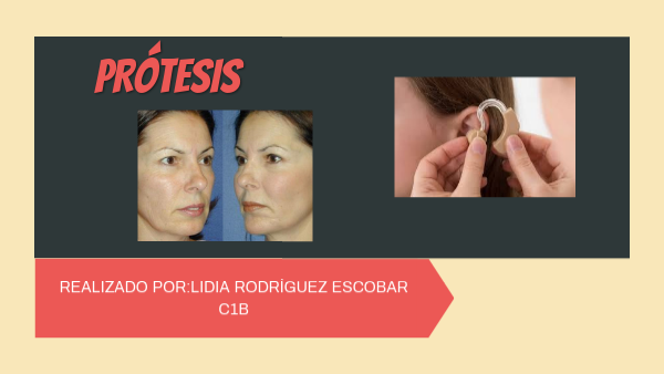 Prótesis