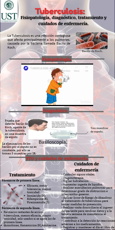 Tuberculosis | Genially