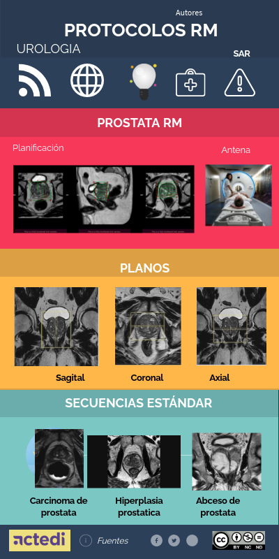 prostata RM | Genially