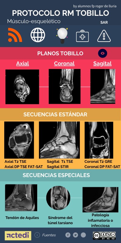 Turmell RM | Genially