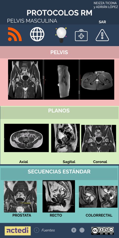 Pelvis osea RM