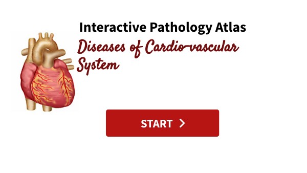 Interactive Pathology atlas-CVS | Genially