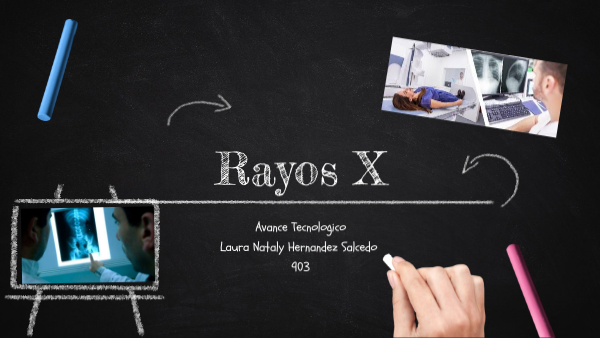 rayos X