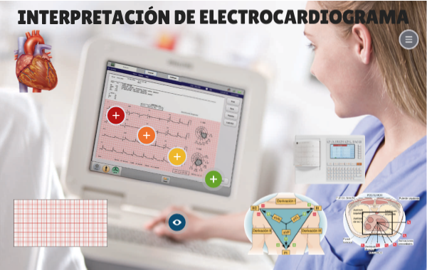 Interpretación de Electrocardiograma | Genially