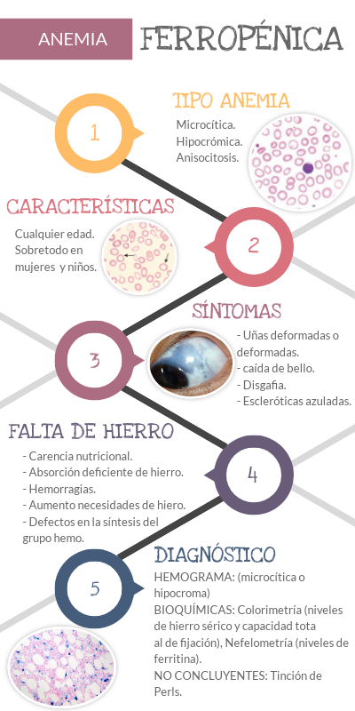 ANEMIA FERROPÉNICA | Genially