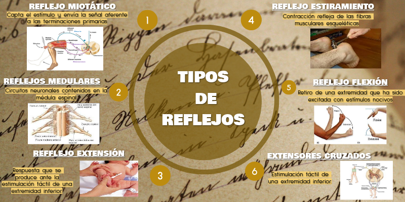 MAPA MENTAL_ TIPO DE REFLEJOS | Genially