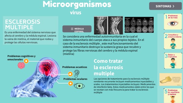 esclerosis multiple | Genially